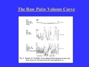Basic Principles of the Pulse Flowmeter | Peripheral Pulse Volume by ...